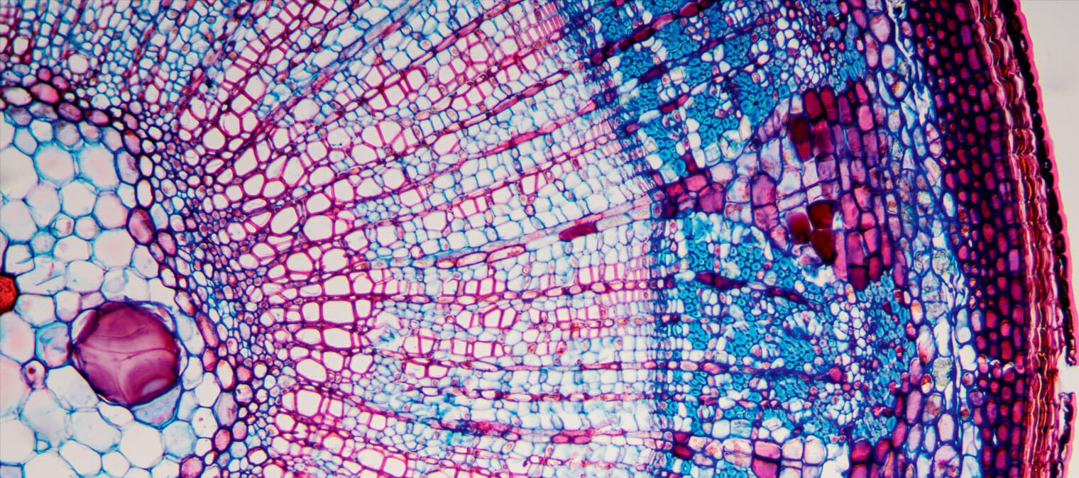 5 examples of cellular stress – MitoQ Ltd